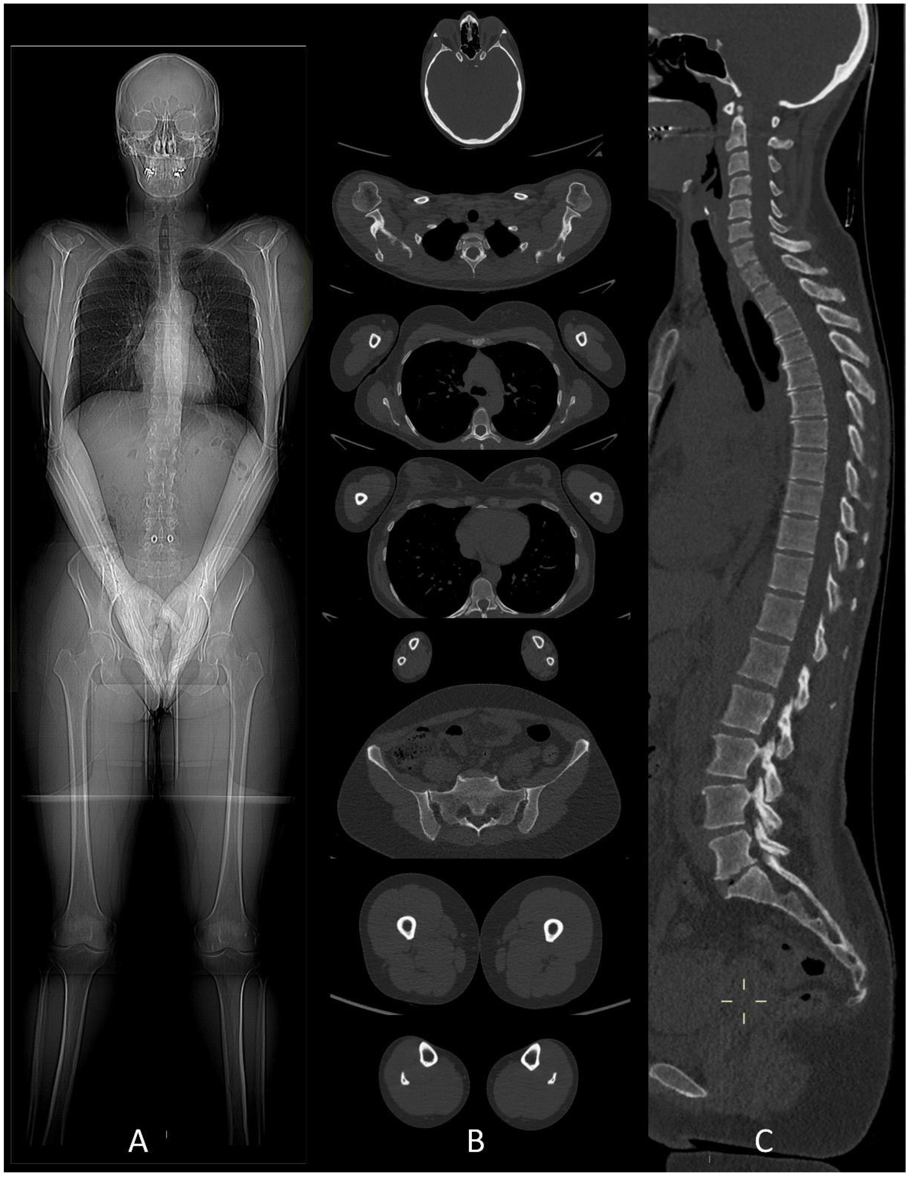 Body-Scanner et patient polytraumatisé | Citadelle